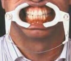 Adjustable Cheek Retractor Wire Type – Ortho Organizers – Prestige ...